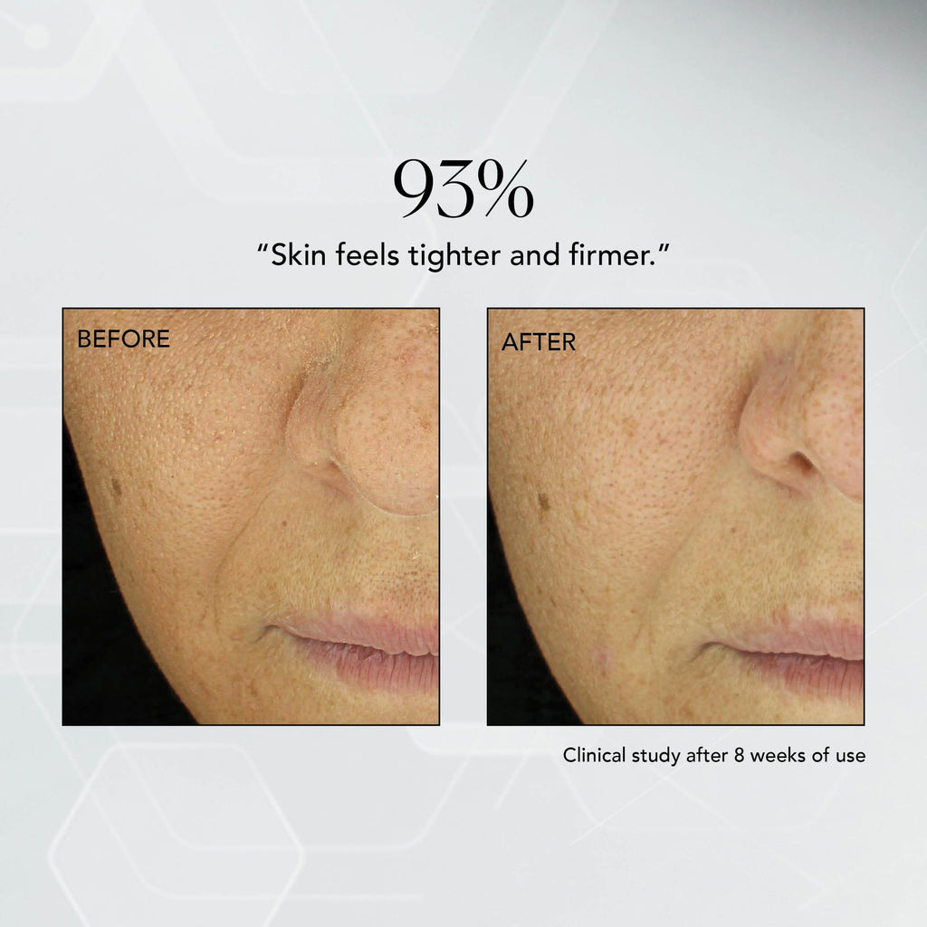 MD Advanced Hydration Crème: Overnight Skin Renewal | MDSolarSciences®